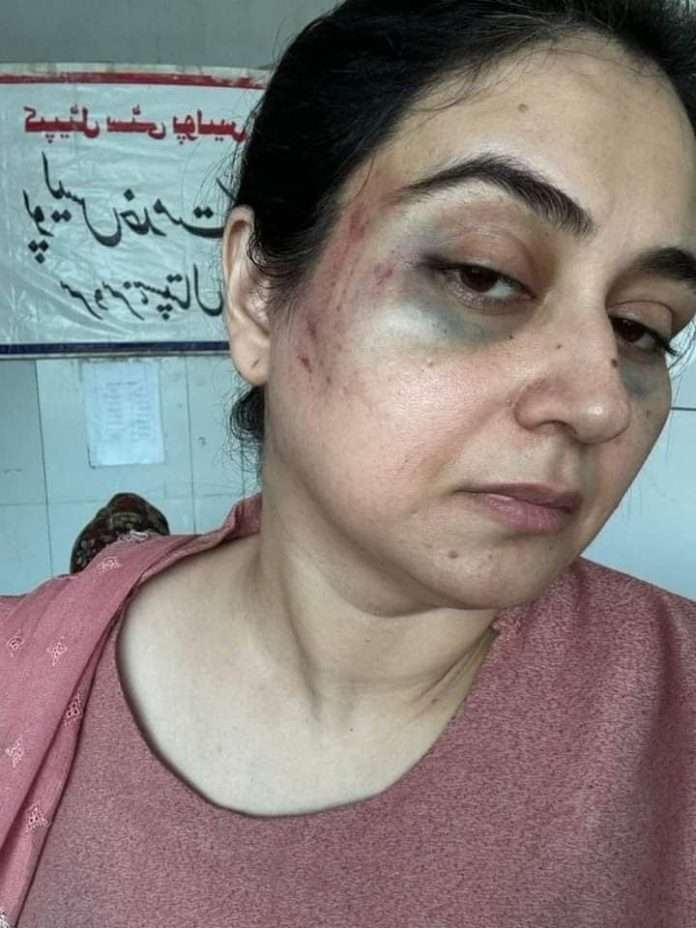 TV Anchor Ayesha Jehanzeb Allegedly Assaulted by Husband: Punjab CM ...